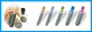XIVE implants (Xive) - reviews, catalog, implant prices